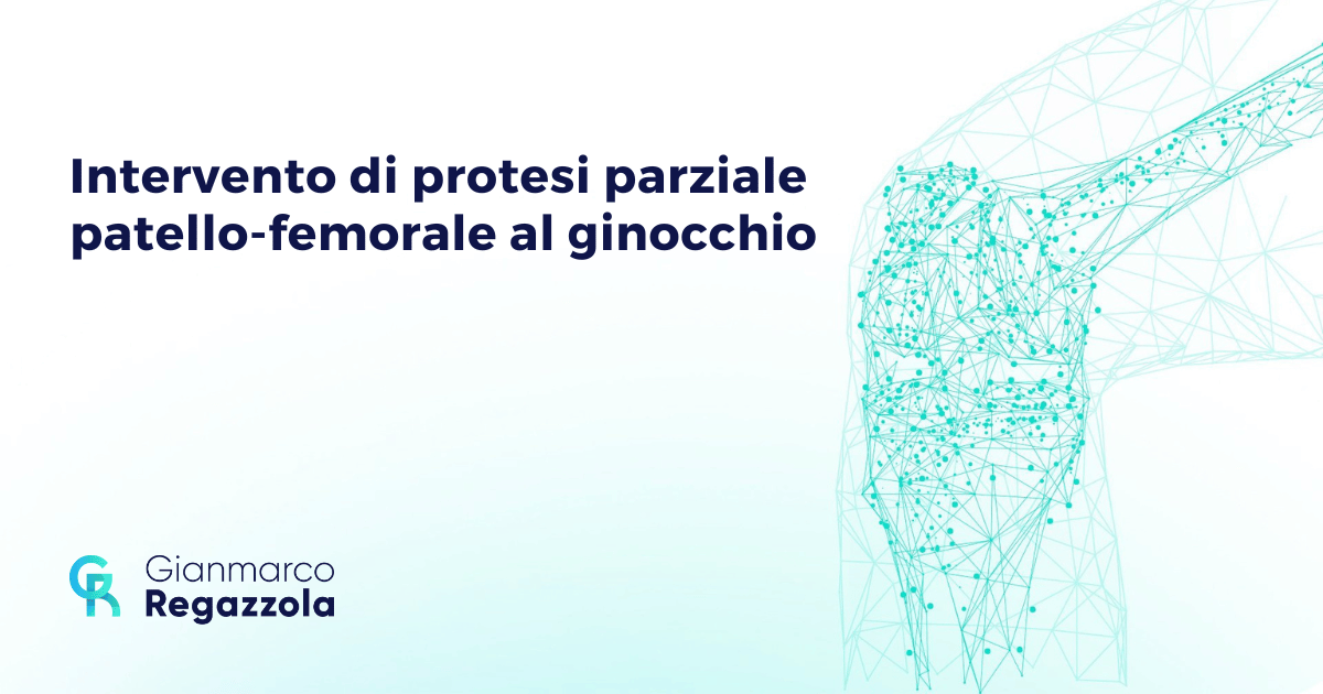 Intervento di protesi parziale patello-femorale al ginocchio - Dr ...