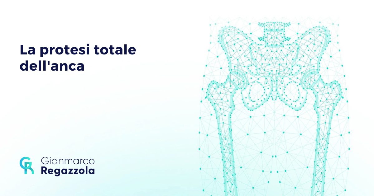 Protesi totale dell'anca - Dr. Gianmarco Regazzola