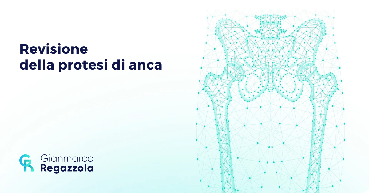 Revisione della protesi di anca - Dr. Gianmarco Regazzola